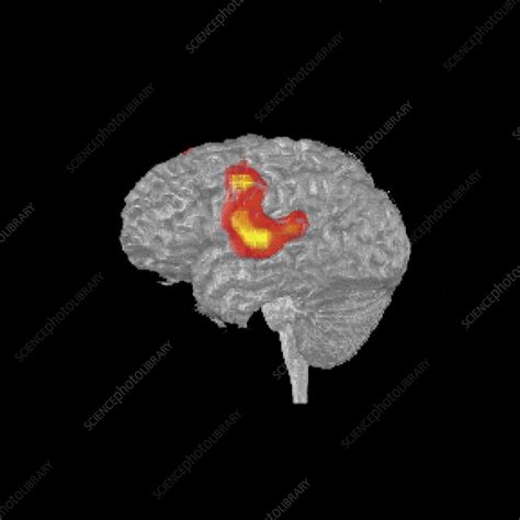 Brain Activity During Speech Stock Image C011 6052 Science Photo Library