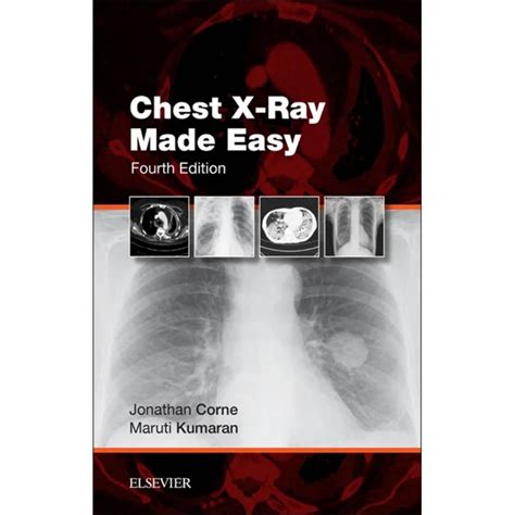Chest X Ray Made Easy 4th Edition Practical Radiology Guide The