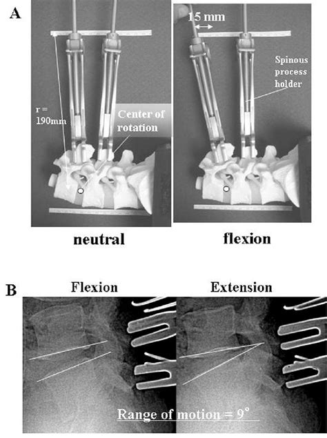A Photographs Of A Spinal Model Showing The Segmental Rotation X