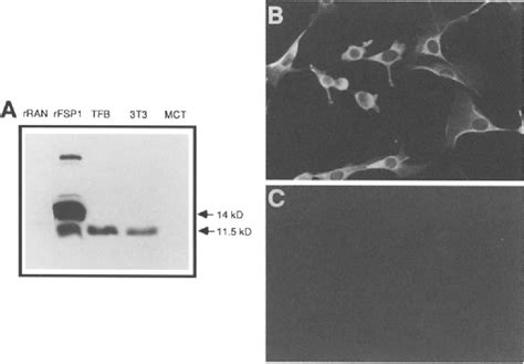 Figure 1 From Identification And Characterization Of A Fibroblast Marker Fsp 1 Semantic Scholar