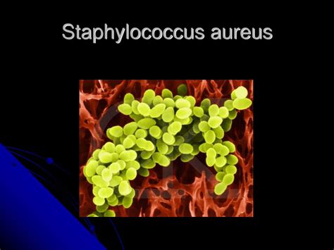 Ppt Lung Abscess Pleural Empyema Tuberculosis Powerpoint Presentation