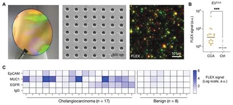 췌장암 만큼 치명적인‘담도암 조기 진단 기술 개발 한국일보 애틀랜타