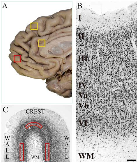 Frontiers Von Economo Neurons In The Human Medial Frontopolar Cortex Frontiers Von Economo Neurons In The Human Medial Frontopolar Cortex