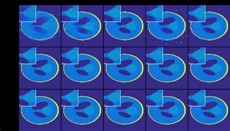 Deep Learning Approaches For Sparse View Ct Download Scientific Diagram