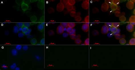 Glycoprotein Recognized By A Leucocarpus Lectin Colocalizes With Download Scientific Diagram