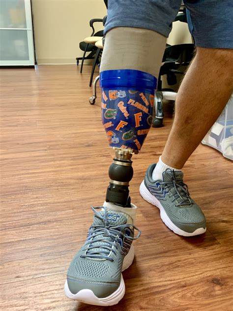 Below Knee Prosthetics Types Of Prosthetic Legs Ohydhc