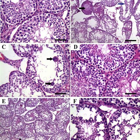 Representative Photomicrograph Of Testicular Tissues Of Rabbits From Download Scientific