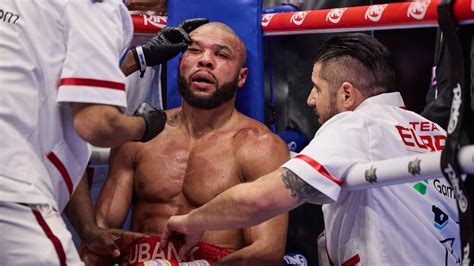 Chris Eubank Sr Reveals Seriousness Of Son Eubank Jrs Condition After