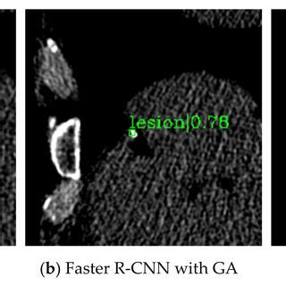 Missed Detection Of Faster R CNN A The Detection Result Of Faster Download Scientific