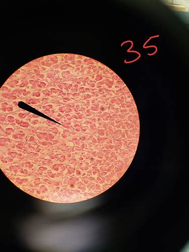 Lab Practicum 1 Slides Flashcards Quizlet
