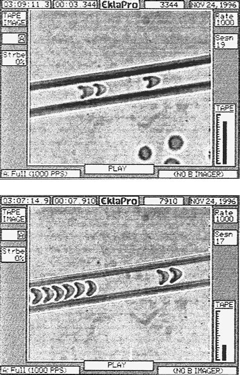 Figure 7 From Direct Measurement Of Erythrocyte Deformability In