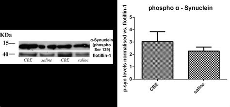 17 Gcase Inhibition Did Not Alter Brain Exosome Associated Download Scientific Diagram