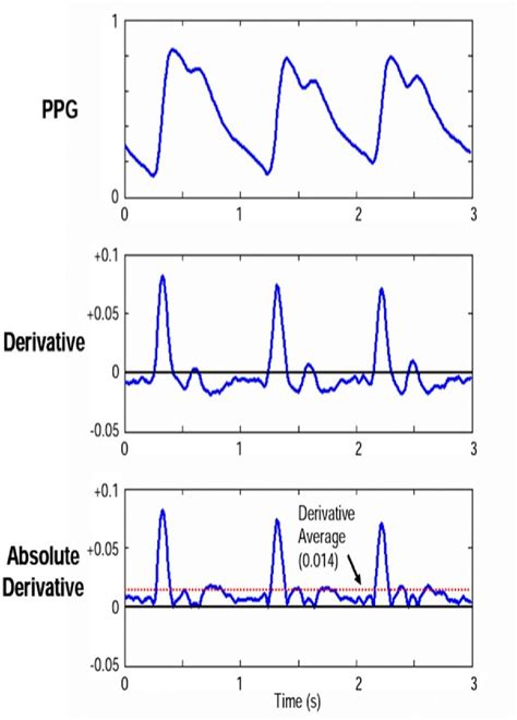 Figure 61 From Development Of Multi Modal System For Extraction Of