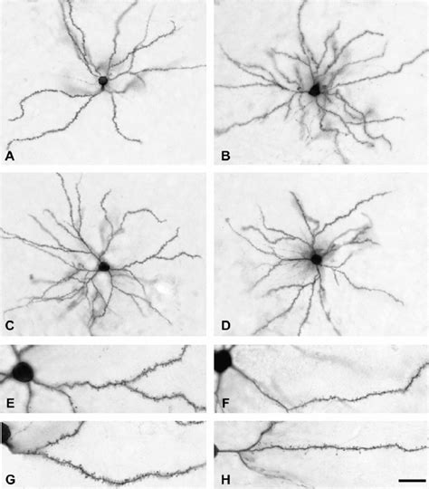 A D Photomicrographs Illustrating Individual Pyramidal Neurons In Download Scientific