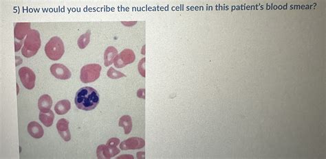 Solved How Would You Describe The Nucleated Cell Seen In