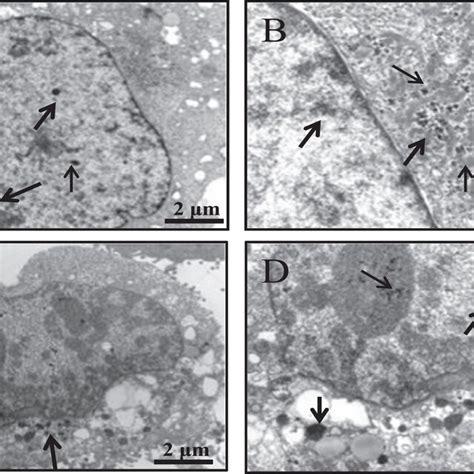 Tem Image Showing Internalization Of Nanoparticles In Hepg2 Cells A
