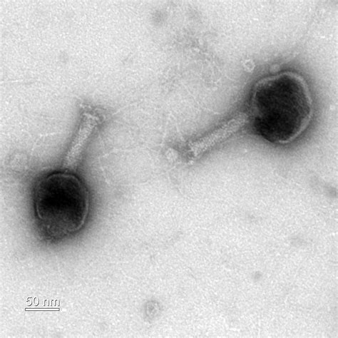 Bacteriophage Virus Electron Microscope