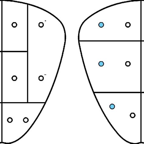 Transperineal Prostate Biopsy A Prostate B Transrectal Ultrasound