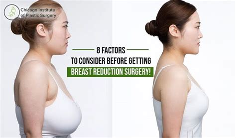 8 Factors To Consider Before Getting Breast Reduction Surgery