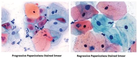 Papanicolaou Pap Staining Introduction Principle Procedure And
