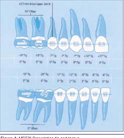 Figure 13 From Space Closure Biomechanics Applied Using The MBT TM System Technique Semantic
