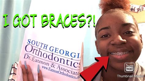 MY FIRST TIME GETTING BRACES YouTube