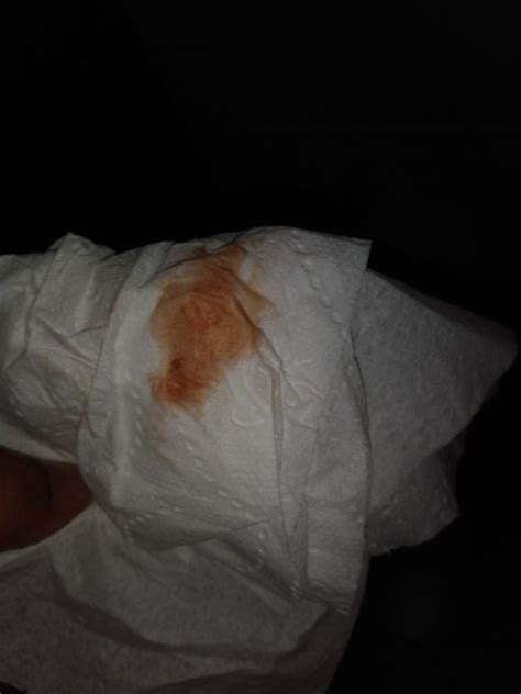 What Does Implantation Bleeding Look Like On A Pad