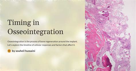 Timing In Osseointegration