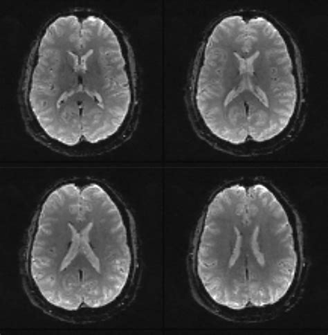 Low Versus Ultra High Field Mri How To Select Your Mri Fleet Applied Radiology