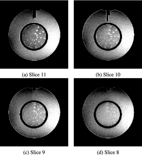 Figure 2 From Using Convolutional Neural Network To Automate Acr Mri
