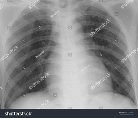 Miliary Afbeeldingen Stockfoto‘s En Vectoren Shutterstock