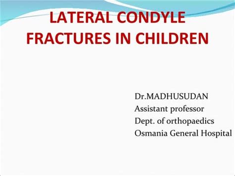 Transtibial Dynamic Alignment Ppt Death Injury Or Military Transtibial Dynamic Alignment Ppt Death Injury Or Military