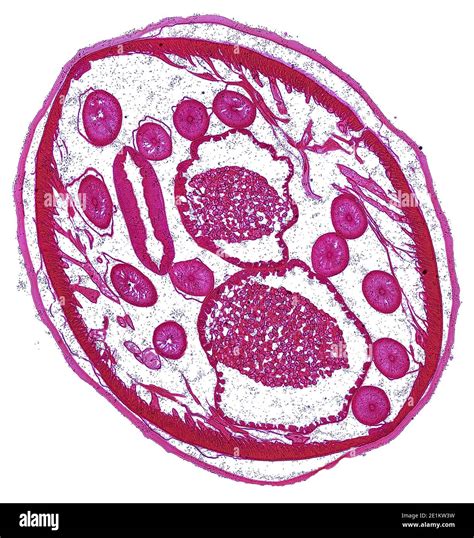Human Genes Under Microscope