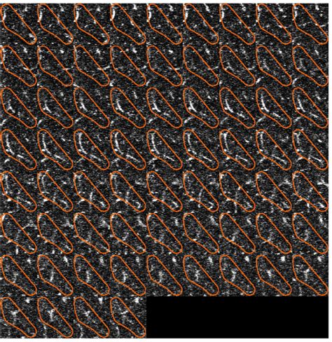 advance alzheimer s research with stall catchers matlab benchmark