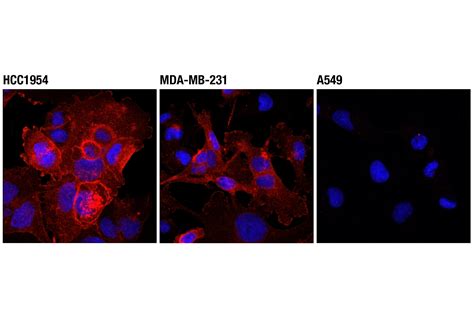 PD L1 Extracellular Domain Specific D8T4X Rabbit MAb Alexa Fluor 555 Conjugate Cell