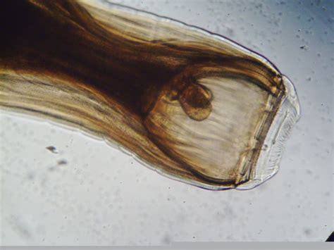 Strongylus Vulgaris Free Images At Vector Clip Art Online