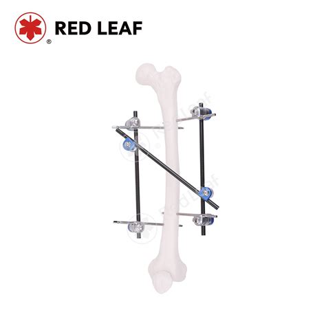 Medical Device Femoral Shaft External Fixator Combination Orthopedic