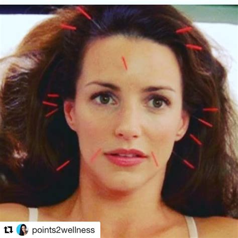 Dr Abbie Acupuncture Throwback To Sex In The City Days Charlotte