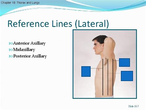 Chapter 18 Thorax And Lungs Chapter 18 Elsevier