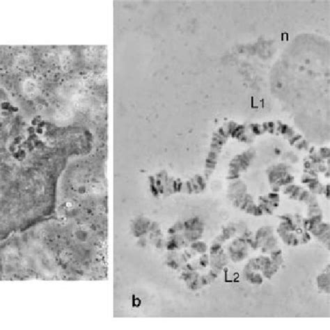 A Pupal Trichogen Cell Of A Scutellar Bristle Of Glossina Pallidipes