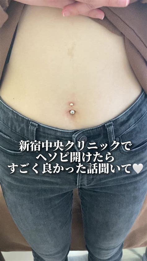 新宿中央クリニックでへそぴを開けた体験レビュー Tiktok