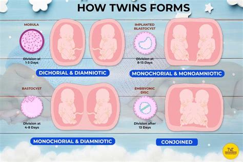 Miracle Multiples Complete Resource For Healthy Twins And Triplets Trendvisionz