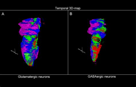 3d Time Map Of Different Neuro Image Eurekalert Science News Releases