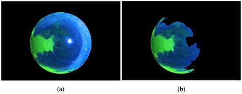 Automated Detection Of Corneal Ulcer Using Combination Image Processing