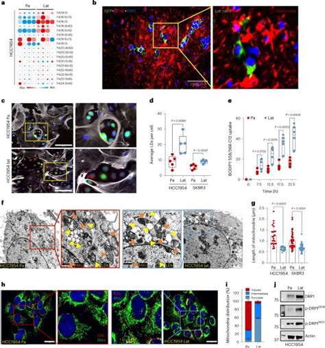 Srinivas Malladi On Linkedin Limiting Mitochondrial Plasticity By Targeting Drp1 Induces