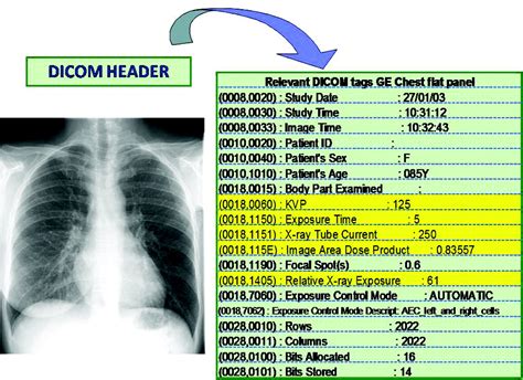 Experience With Patient Dosimetry And Quality Control Online For Diagnostic And Interventional