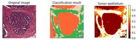 Github Gayagorodecki Colorectalhistologyclassification Python Deeplearning Python Program