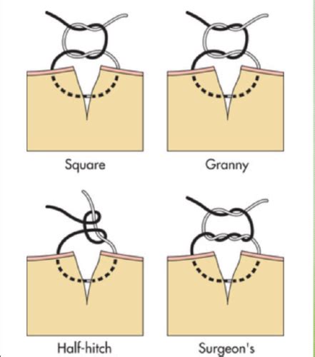 Knots Ligatures And Suture Patterns Flashcards Quizlet