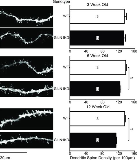 Representative Images Left And Quantifications Right Of Dendritic