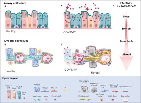 Sars Cov 2 Infection In The Respiratory Tract A In The Download